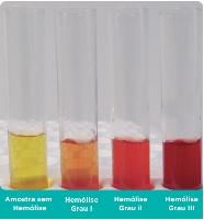 HEMÓLISE – DICAS PARA EVITAR E PRINCIPAIS CAUSAS - CARTAZ - Materiais ...